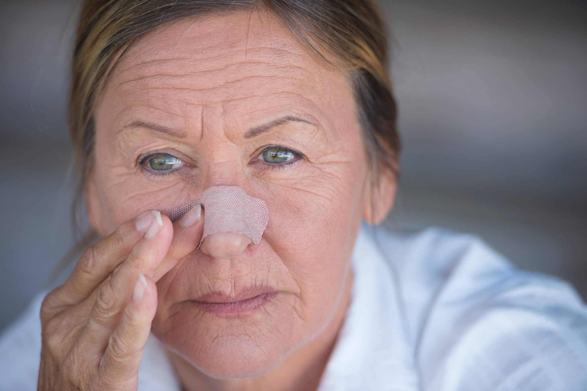 Nasal Fracture | Wooster Ear, Nose, & Throat Associates